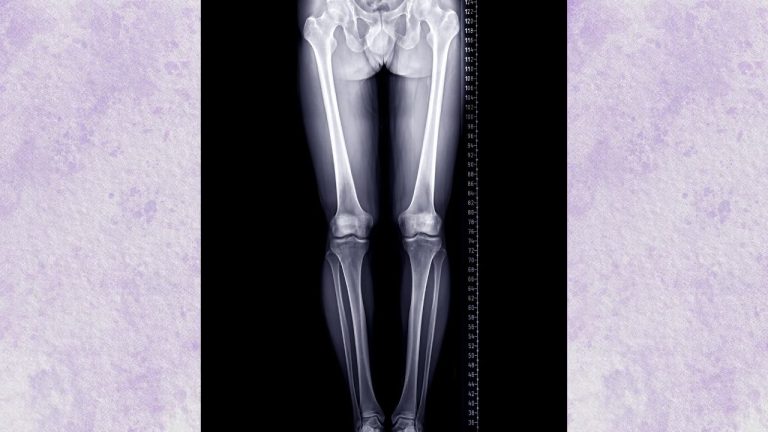 alineacion correcta del cuerpo Archivos - UltraMed- Plantillas ...